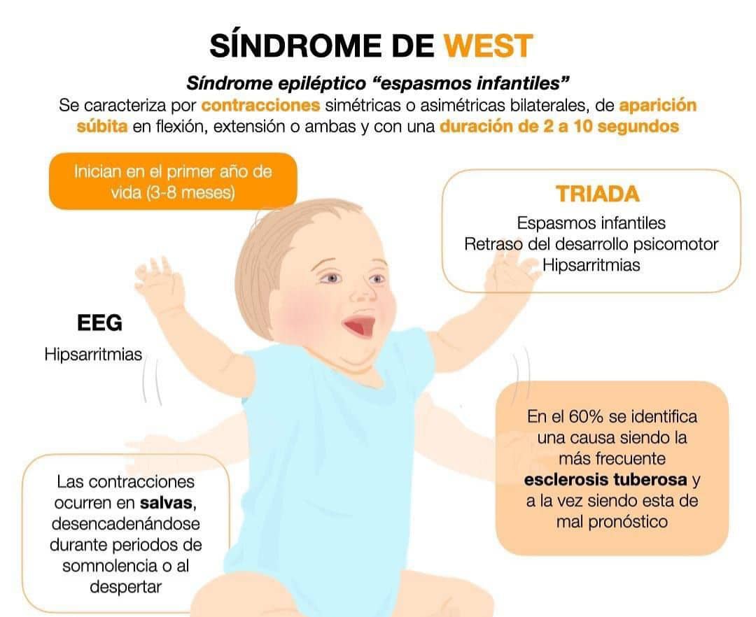 Sahum alerta sobre el síndrome de West: Una rara epilepsia que afecta a ...